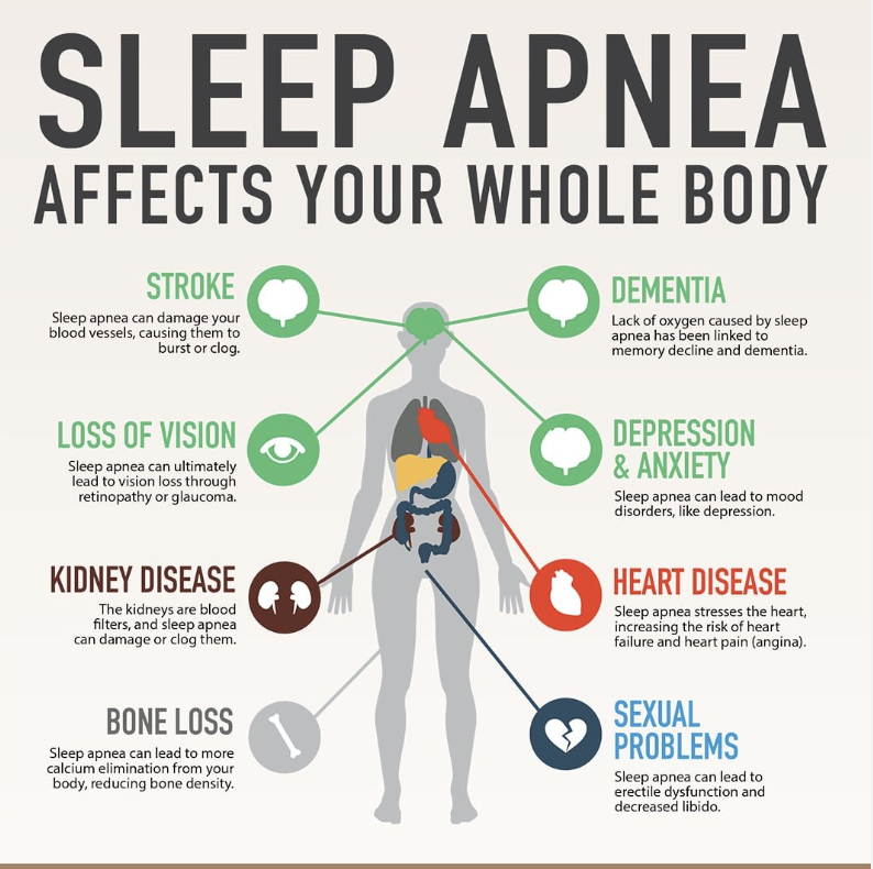 9 Early Signs of Obstructive Sleep Apnea for Better Health
